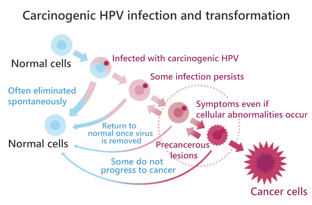 What is cervical cancer? - Tokyo Midtown Clinic